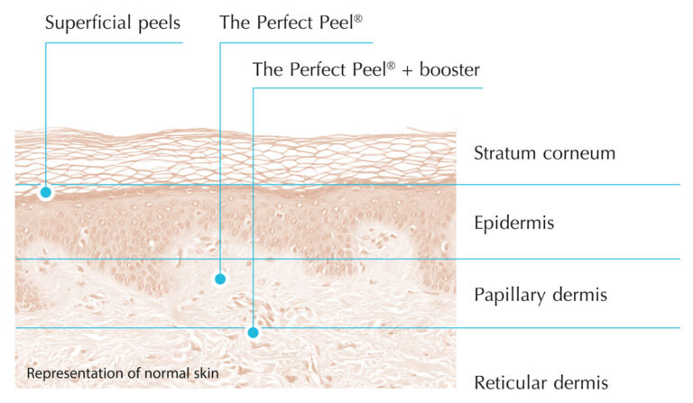 The Perfect Peel London Marylebone - b.e.a Skin Clinic